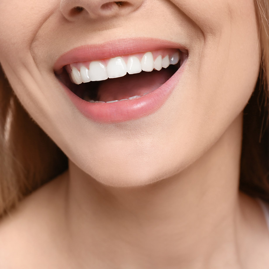 Adult Straight Teeth - Dental 397 | Dentist in Exeter, Devon