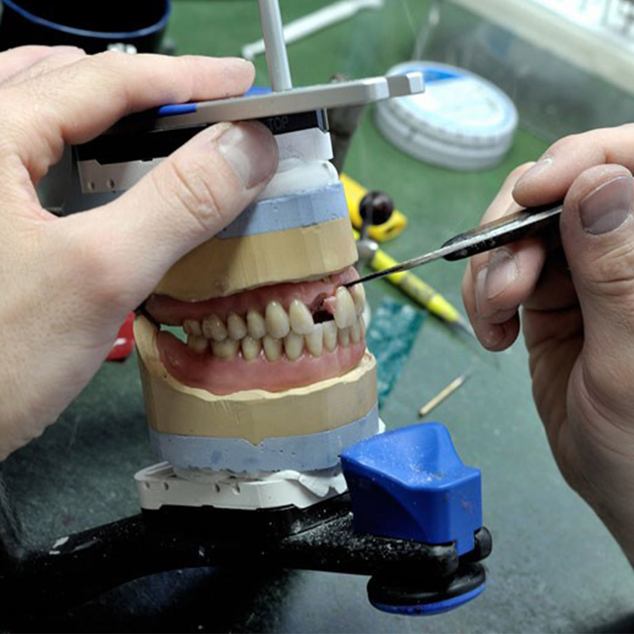 Dentures And Denture Repair - Dental 397 | Dentist in Exeter, Devon